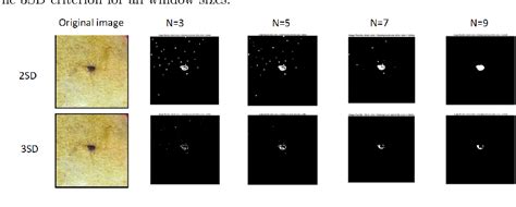 Figure 1 From Automatic Defect Detection For Mango Fruit Using Non