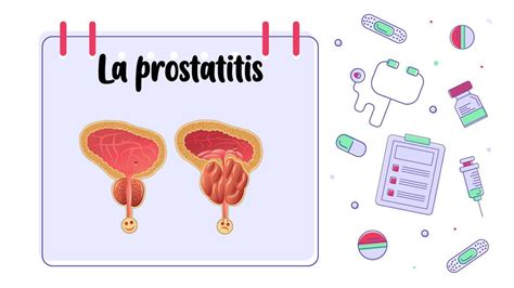 La Prostatitis Nutrillab Udocz