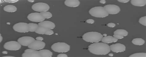 Small Colony Variant Staphylococcus Aureus Multiorgan Infect The Pediatric Infectious