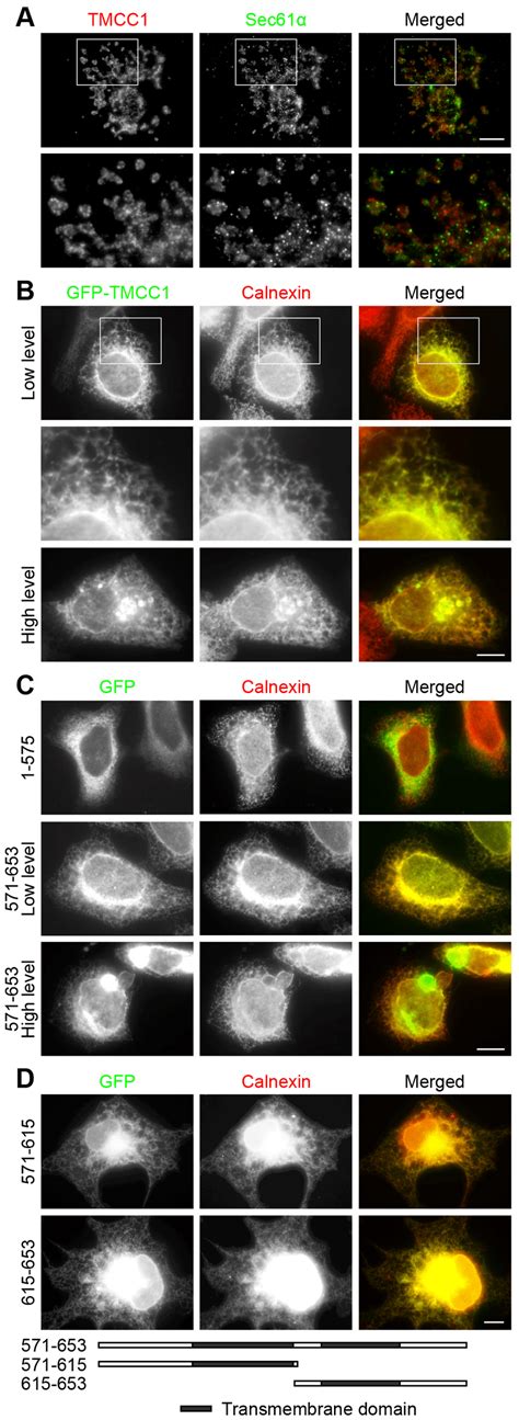 Subcellular Localization Of Tmcc1 A Saponin Extracted Cos 7 Cells Download Scientific