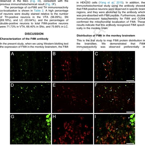 Double Immunofluorescent Staining For Ftmt Green And Th Red