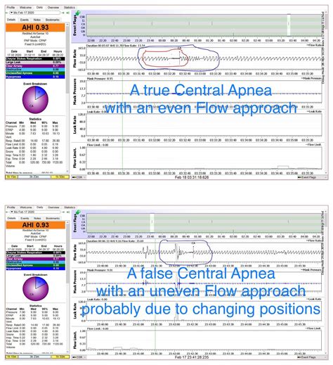 When You Look At Your Data In Oscar This Is How To Tell The Difference Between A True And A