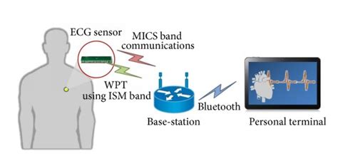 The Concept Developing The ECG Monitoring System Download Scientific Diagram