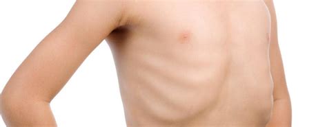 Simptom Malnutrisi Hello Doktor