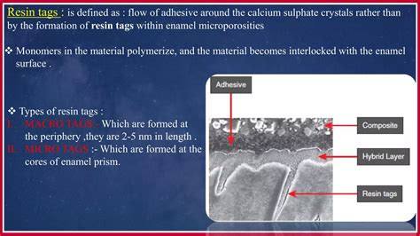 Dental Adhesive System Pptx