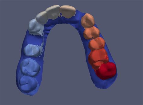 Teeth Landmark 02 Object Detection Dataset And Pre Trained Model By Uaeu2