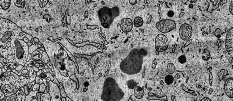 Understanding Brain Connectivity Analysis