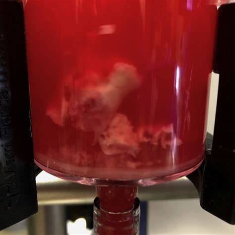 Vegetation Material Caught By The Reservoir Of The Angiovac System