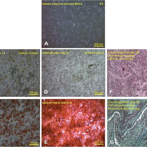 A The Fibroblastic Morphology Of Human Adipose Derived Mscs B Download Scientific Diagram