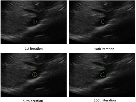 The Rectangle Evolution Versus Number Of Iterations Download Scientific Diagram