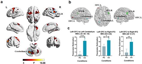 Ppi Analysis Results Of The Seed Based Left Ofc A Brain Regions Of