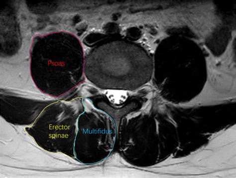 Age And Sex Dependent Differences In The Morphology And Composition Of