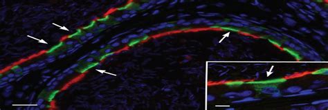 Regulation Of Epithelial Function Differentiation And Remo Asian Journal Of Andrology