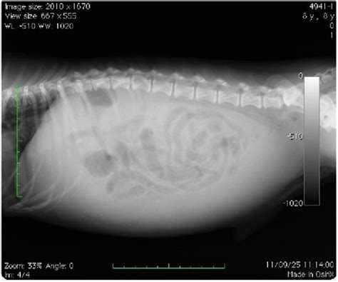Abdominal Radiograph Showing Ascites Download Scientific Diagram