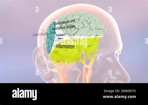 Amyloid Precursor Protein Stock Videos And Footage Hd And 4k Video