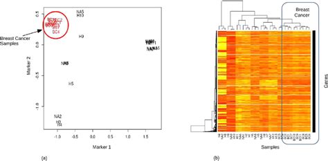 clustering of breast cancer and healthy individuals a mds plot of