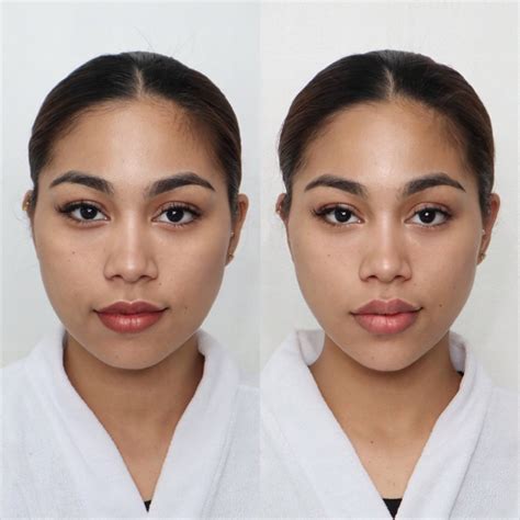 y contour prettylooks aesthetic center