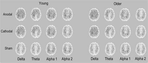 Functional Coupling An Arbitrary Threshold Was Used To Illustrate