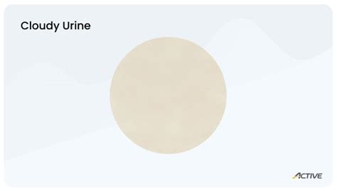 Urine Color Chart Whats Normal And When To See A Doctor Urinal
