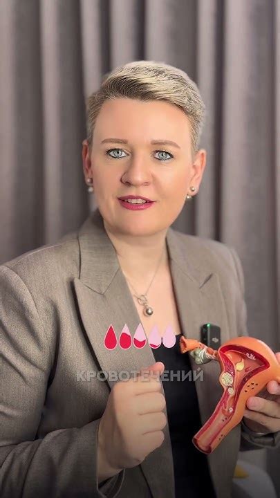 Эндометриоз это не приговор Youtube