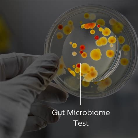 Indias Most Advanced Gut Microbiome Test Sova Health
