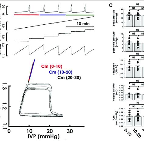 Cystometry And Pressure Volume Analysis A Cystometry Showing That