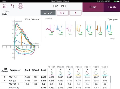 Site Based Spirometry Fev1 Fvc Pef And More Clario