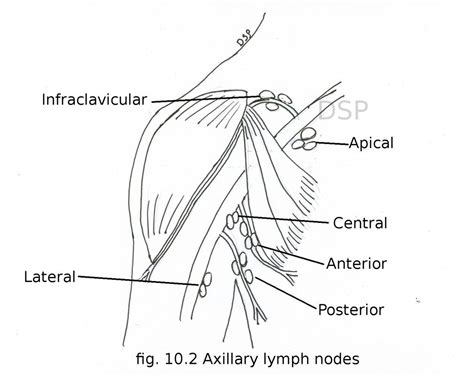 Abscess Left Axilla Axillary Abscess With Streptococcus Pyogenes A
