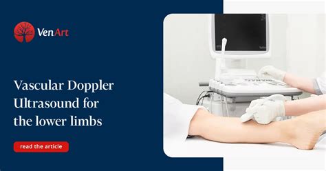 How To Perform A Doppler Ultrasound
