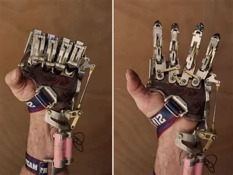 سفارش طراحی پروتز دست انواع دست مصنوعی هوشمند کلینیک یگانه