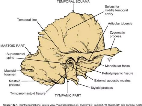 Mastoidectomy Types Indications Procedure Pdf