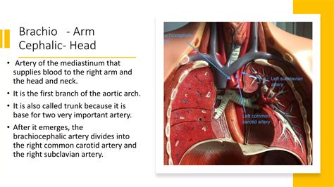 Brachiocephalic Arterypptx