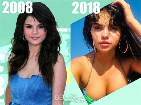 Selena Gomez Plastic Surgery Revealed Before And After 2018