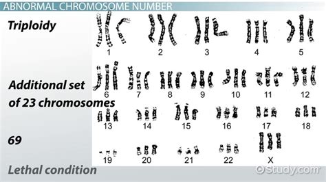 Chromosome Abnormalities List