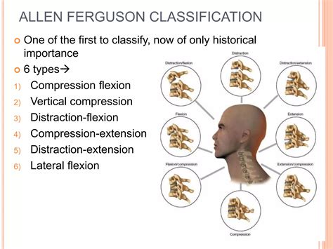 Cervical Spine Fracture Radiology Classification And Management Pptx