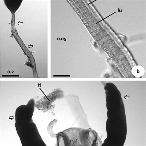 Transmission Electron Microscopy Of Subimagos Sperm And Cell Fragments