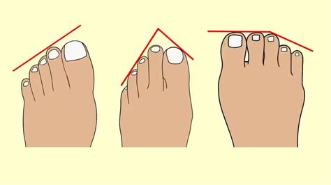 People With Roman Foot Shape Are True Leaders Which One Are You Check