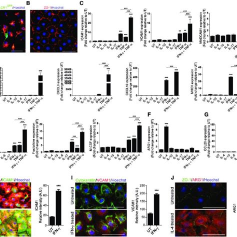 Choroid Plexus Epithelial Cells Upregulate Trafficking Molecules In