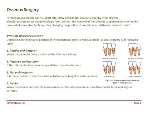 037 Osseous Surgery Pdf