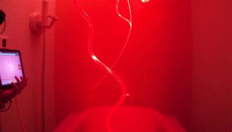 Venous Pooling Chronic Venous Insufficiency Symptoms Causes