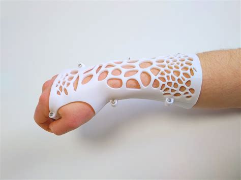 Arm Splint 3d Print 3d Model 3d Printable Cgtrader