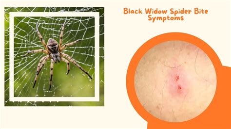 17 Types Of Spider Bite Symptoms Id With Pictures