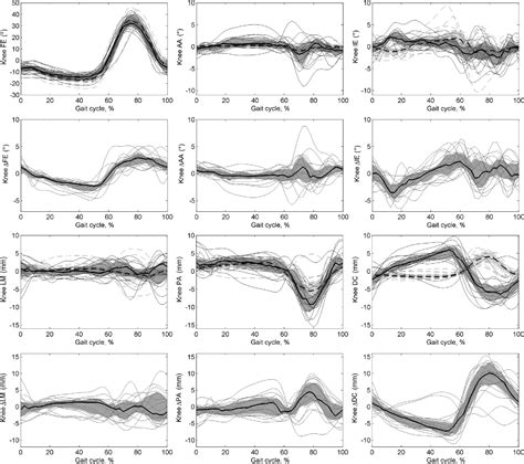 Figure 1 From Soft Tissue Artifact Assessment During Treadmill Walking In Subjects With Total