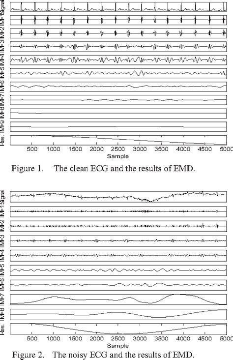figure 1 from a new qrs detector based on empirical mode decomposition