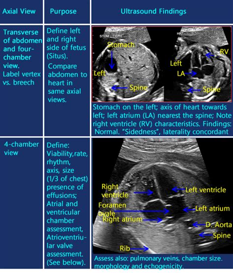 Normal Fetal Heart Ultrasound Ob Images