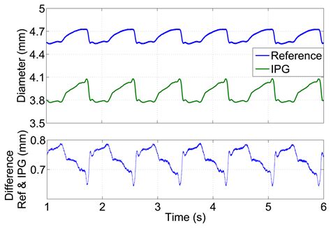 Implantable Impedance Plethysmography