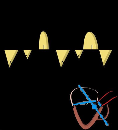 Myocardial Performance Time Or Tei Index