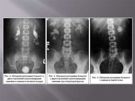 Рентгенологические методы исследования заболеваний почек и мочевыводящих путей в педиатрии