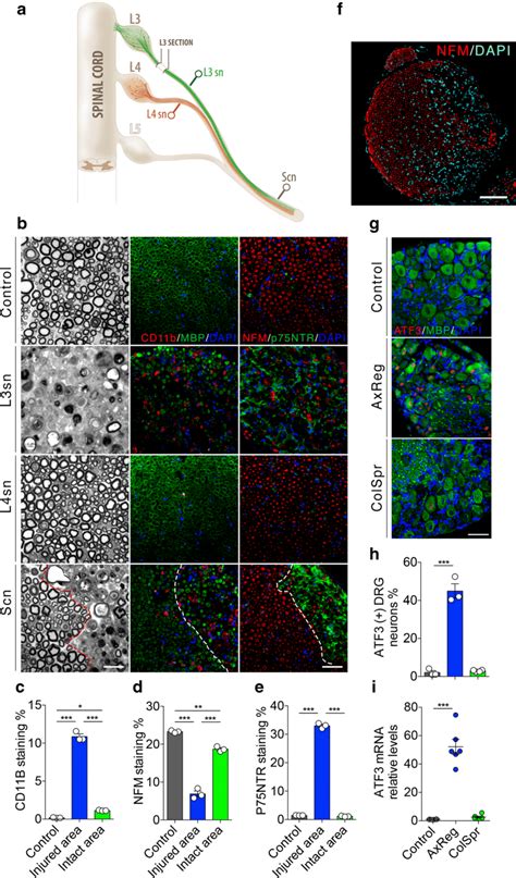 Characterization Of Wallerian Degeneration In Sciatic Nerve After L3