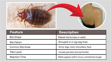 Bed Bug Bite Identification Chart With Pictures